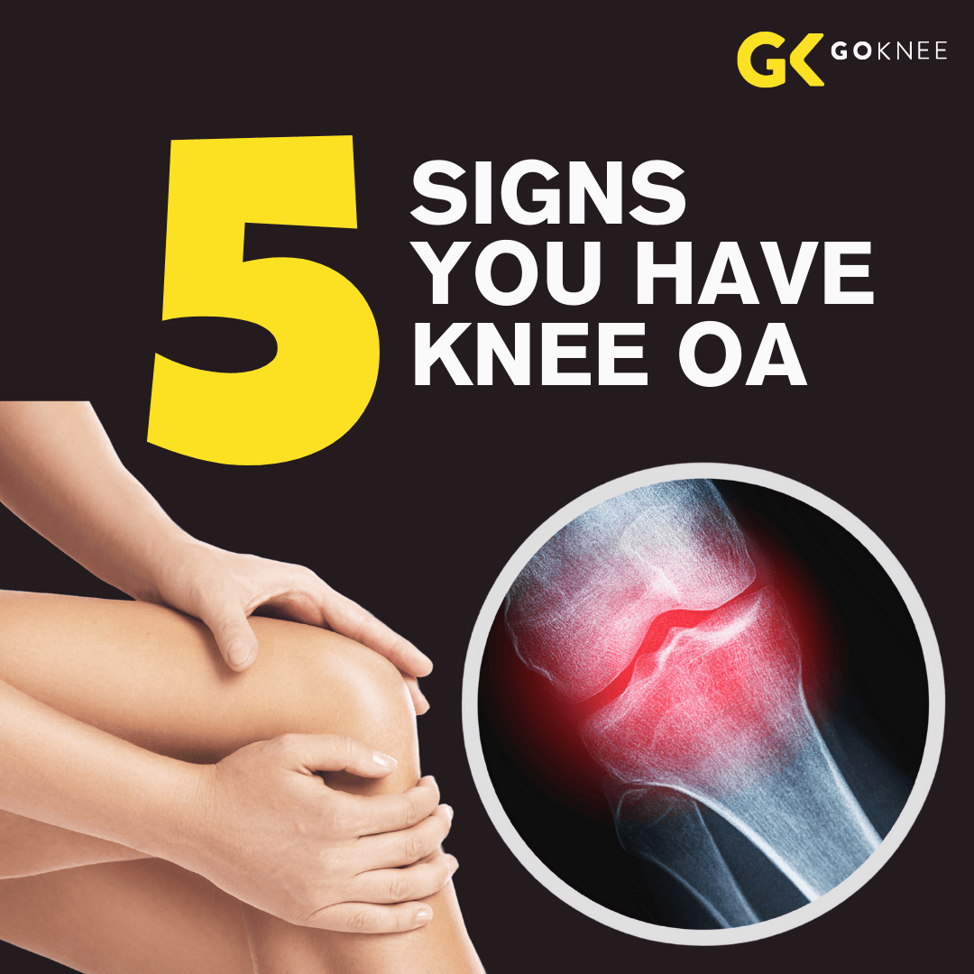 5 Signs You Have Knee Osteoarthritis - GoKnee