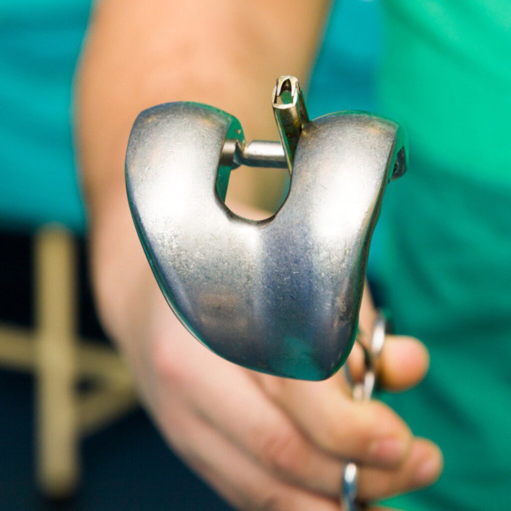 Everything You Need to Know About Artificial Knee Implants